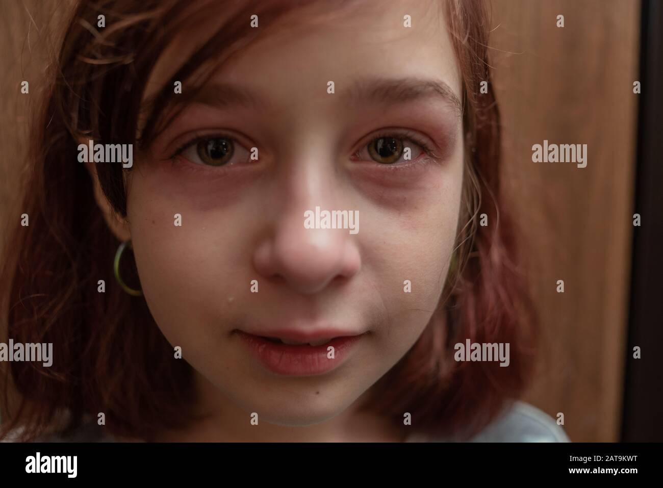 Tear rolling down face hi-res stock photography and images - Alamy