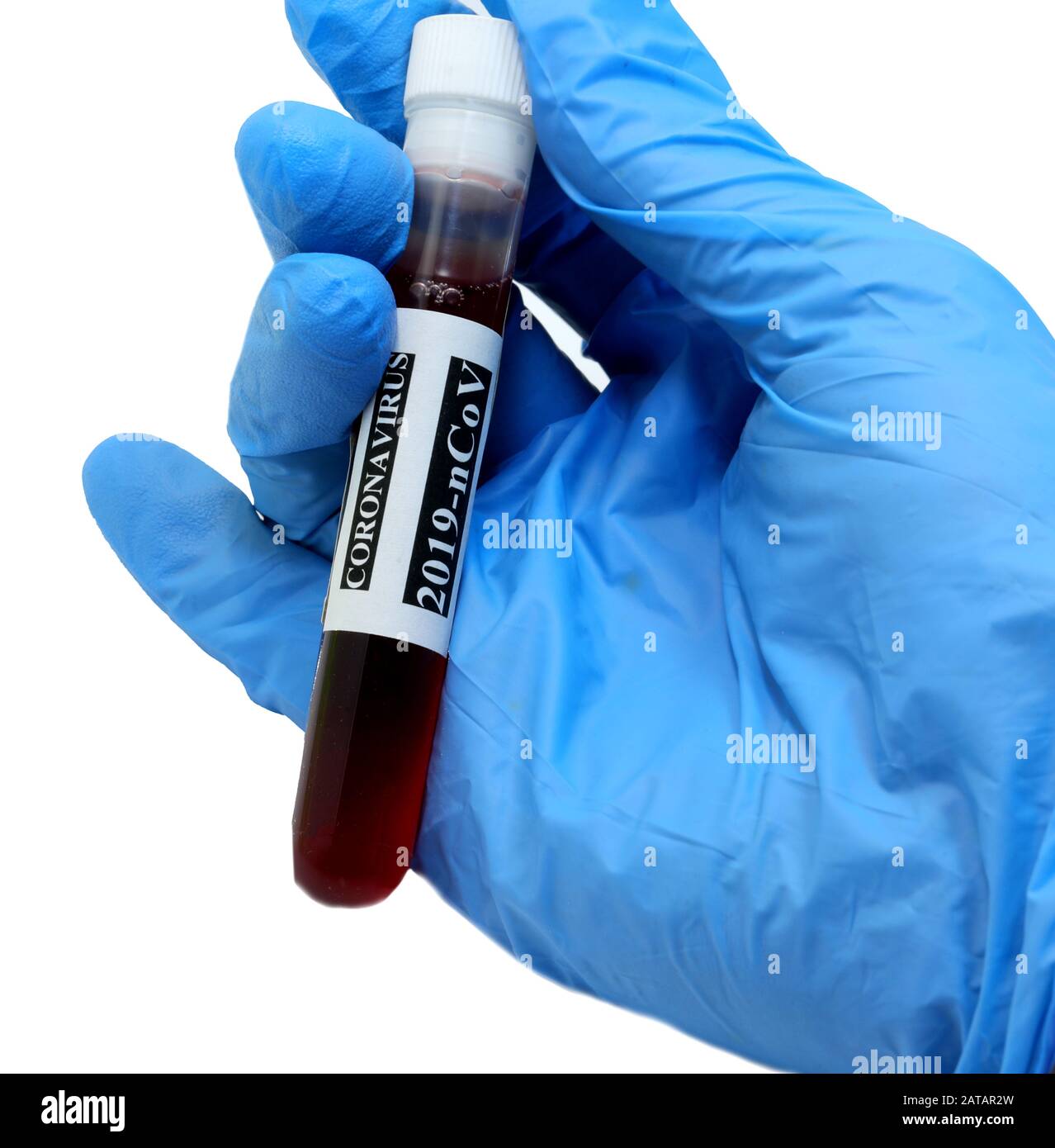 Blood tests hi-res stock photography and images - Alamy