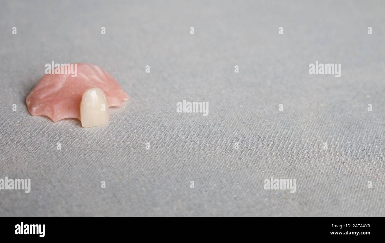 One false plastic tooth. Dental prosthetics on a background. Dentures ...
