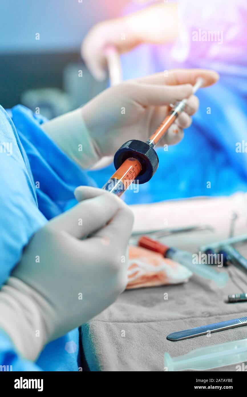 Hands Holding Syringe and Transfer Fat with Nano Fat Transfer Tool in ...