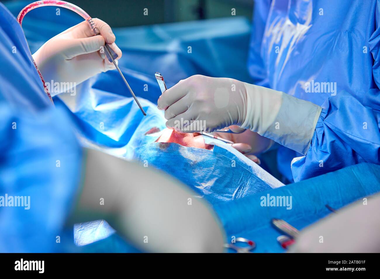 Surgeon and his assistant performing cosmetic surgery on nose in ...
