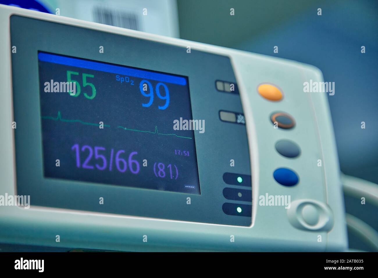 Electrocardiogram in hospital surgery operating emergency room showing ...