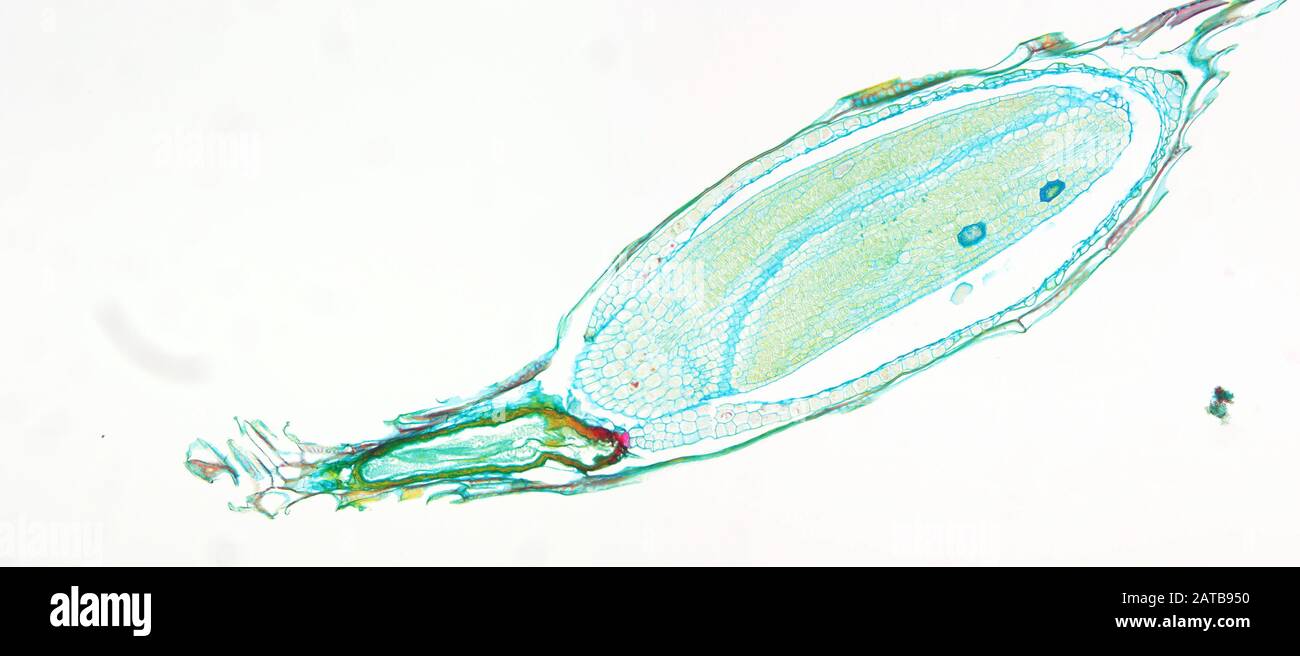 Plant Cells of Hydrangea paniculata Stock Photo - Alamy