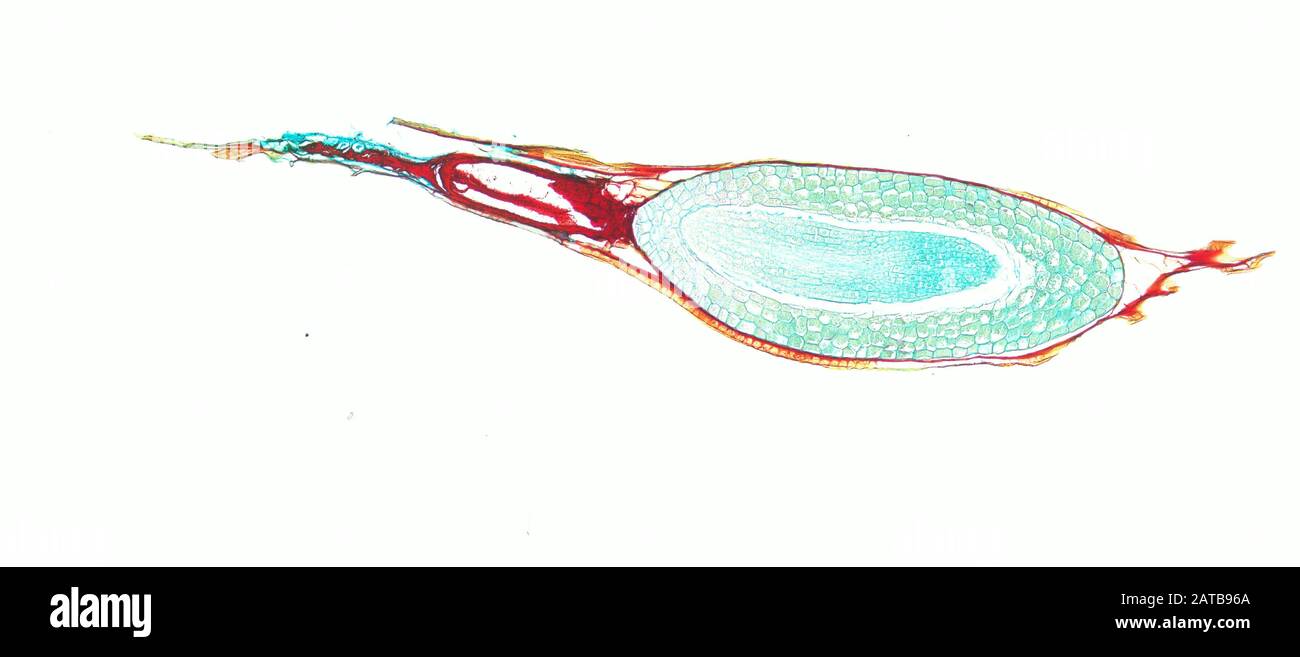 Plant Cells of Hydrangea paniculata Stock Photo - Alamy