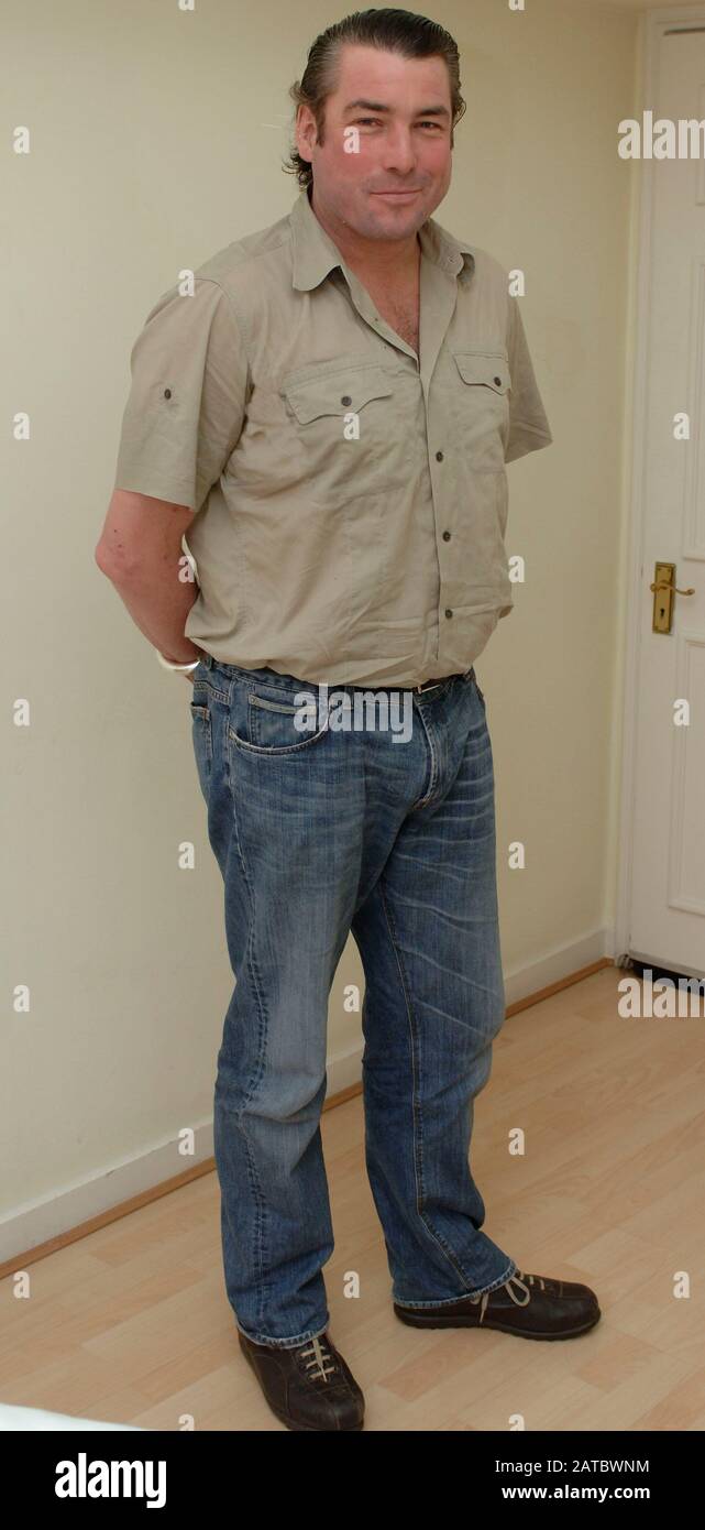 TV chef Ross Burden undergoing an acupuncture procedure at the Hale ...