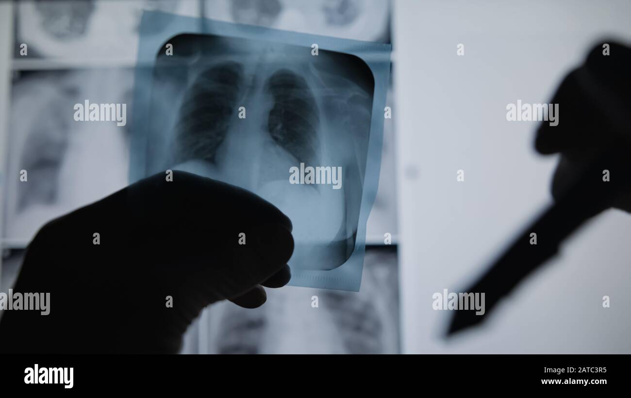 Professional medical team examining a patient's radiography, Medical ...