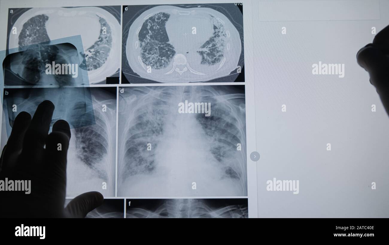 Professional medical team examining a patient's radiography, Medical ...