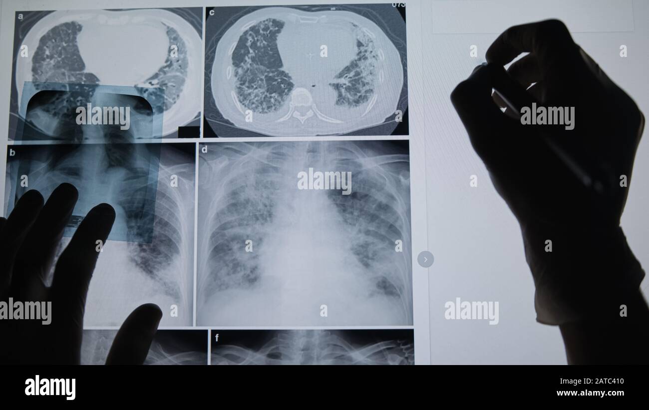 Professional medical team examining a patient's radiography, Medical ...