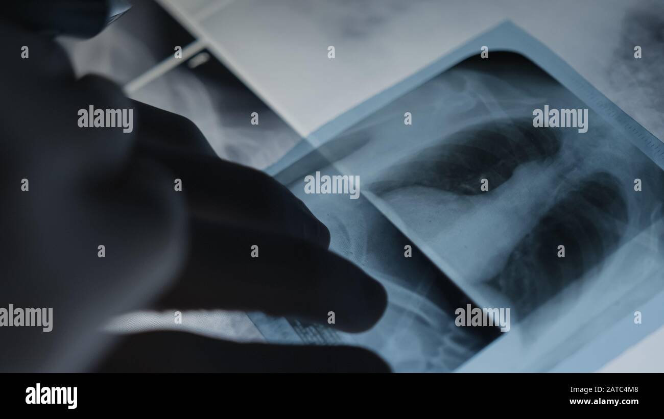 Doctor examining chest x-ray film of patient at hospital.Medical ...