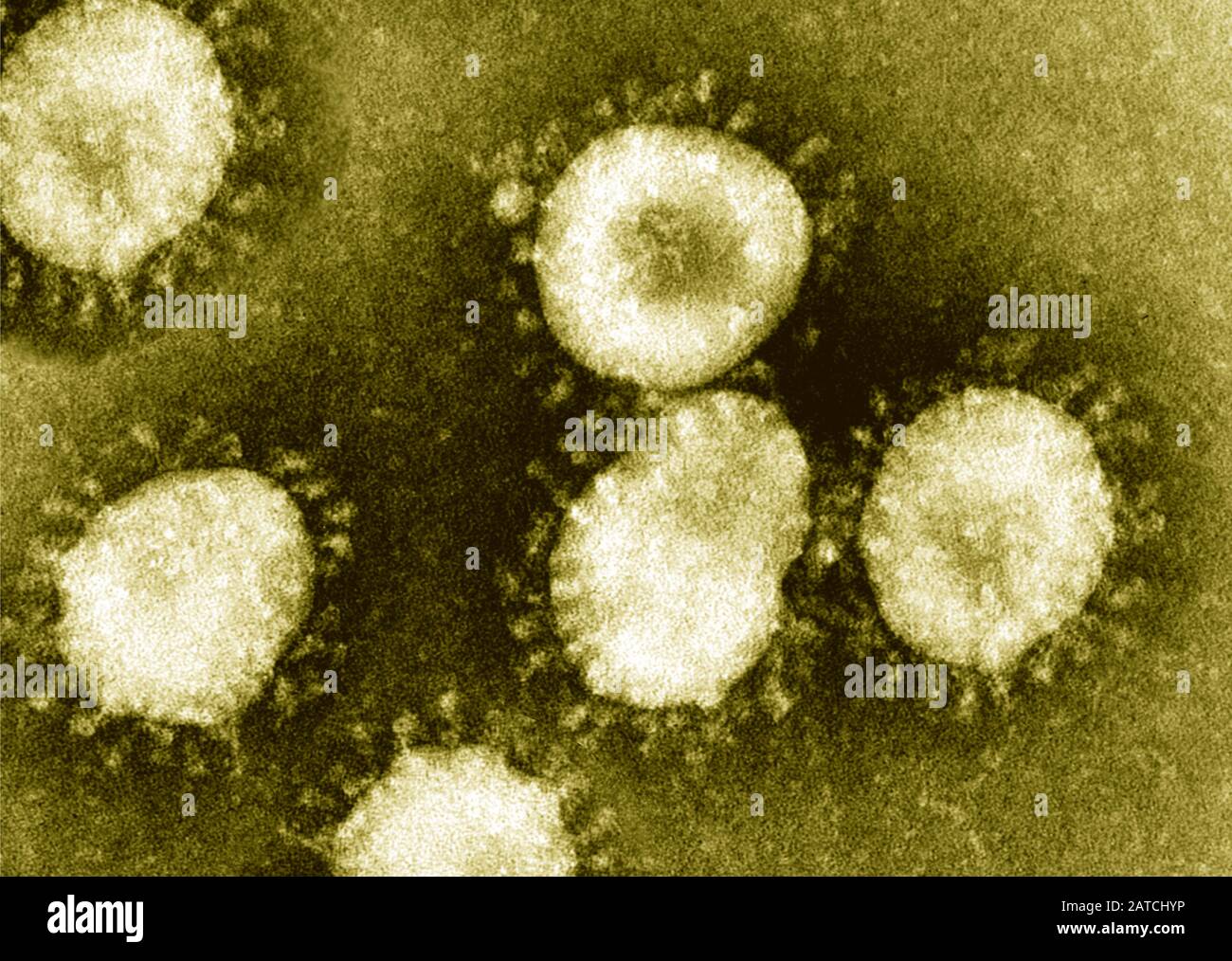Electron microscopy hi-res stock photography and images - Alamy