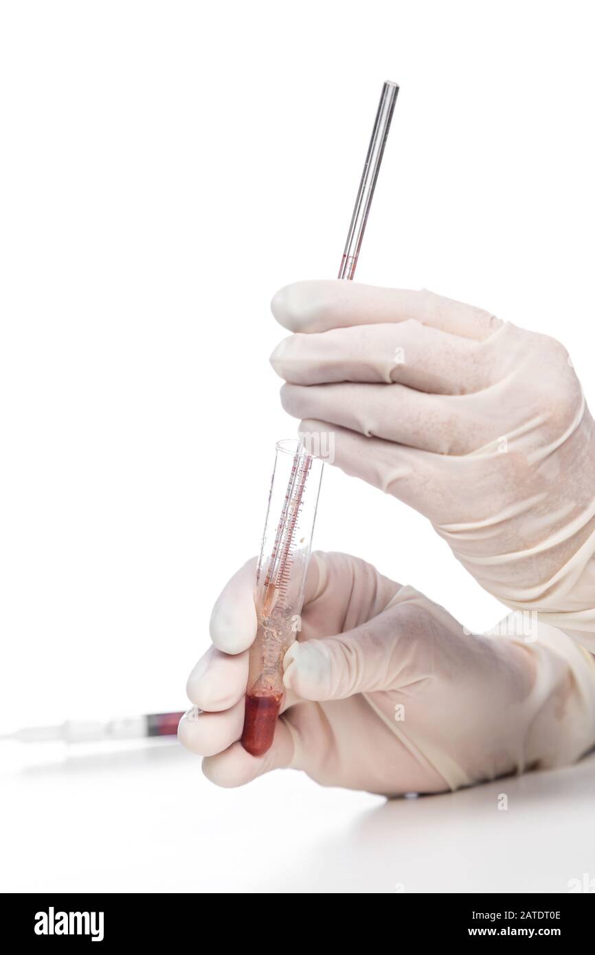 Hand of laboratory assistant holding test tube with blood sample on ...