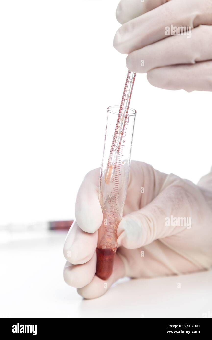 Hand of laboratory assistant holding test tube with blood sample on ...