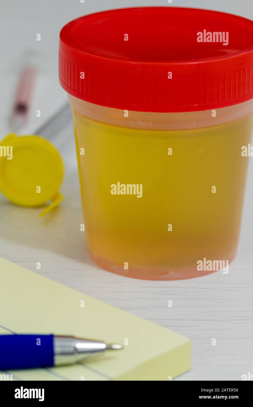 Urine container for testing and laboratory instruments. The concept of ...
