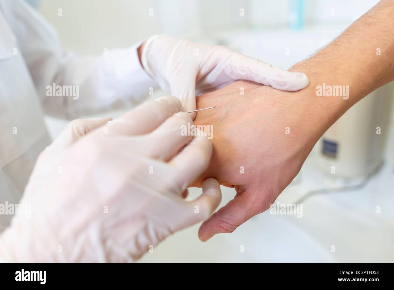 Doctor injects an infusion needle into a patient Stock Photo - Alamy