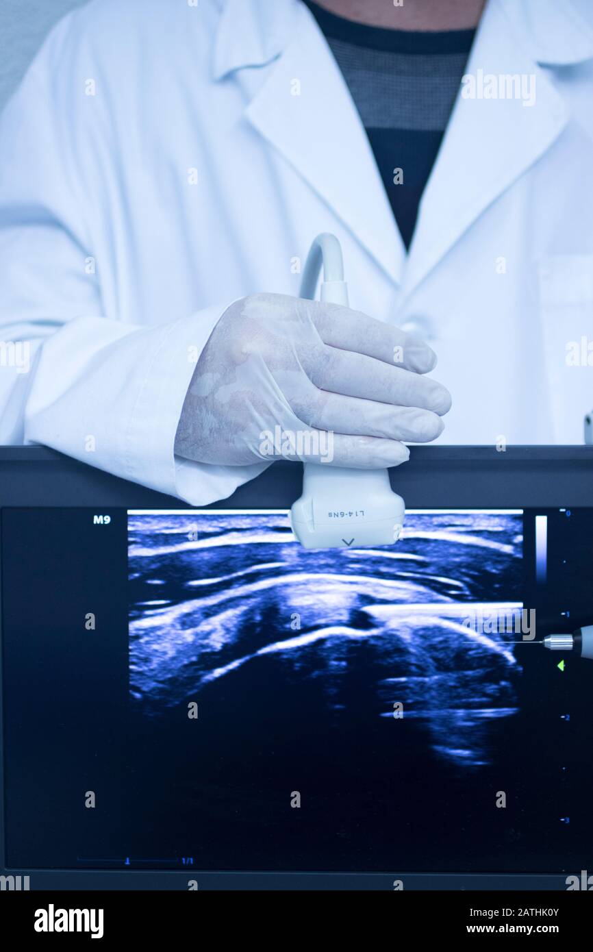 EPI Intratissue Percutaneous Electrolysis dry needling ultrasound ecography scan physiotherapy ...