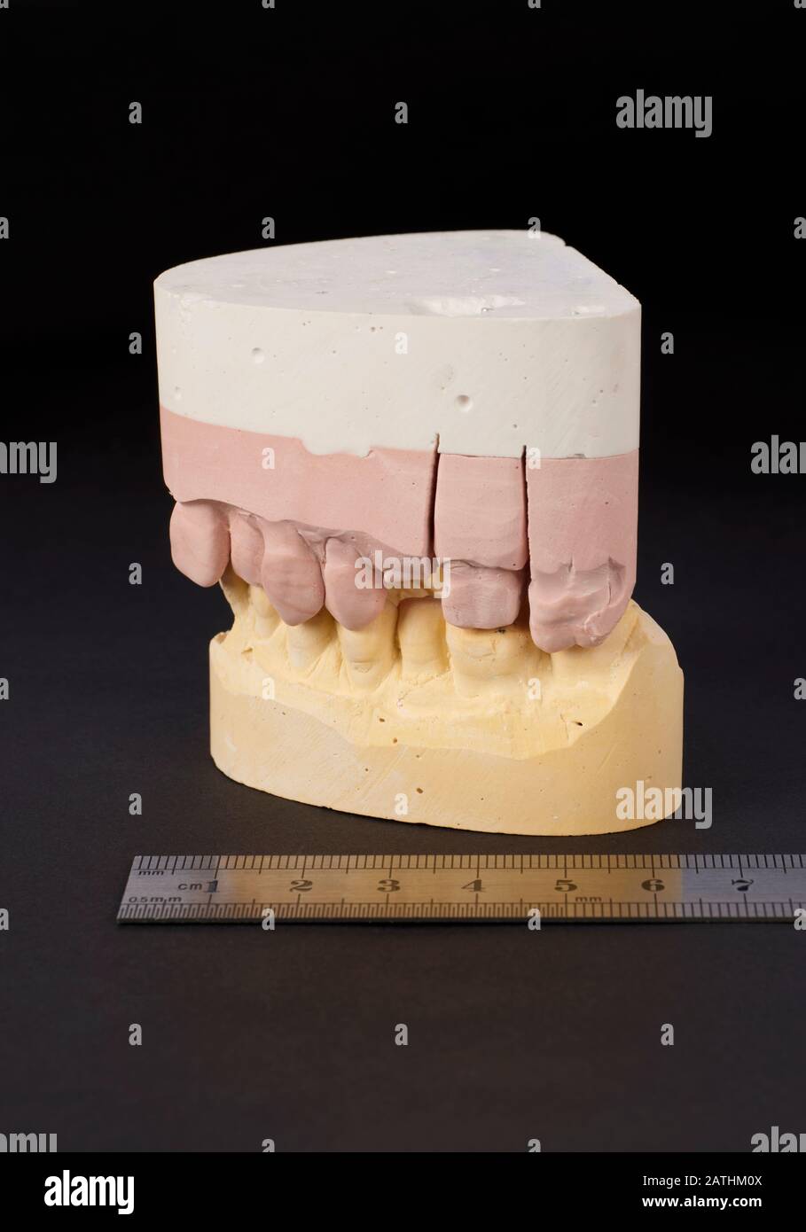 Plaster casts of upper and lower teeth from middle-aged human male in ...