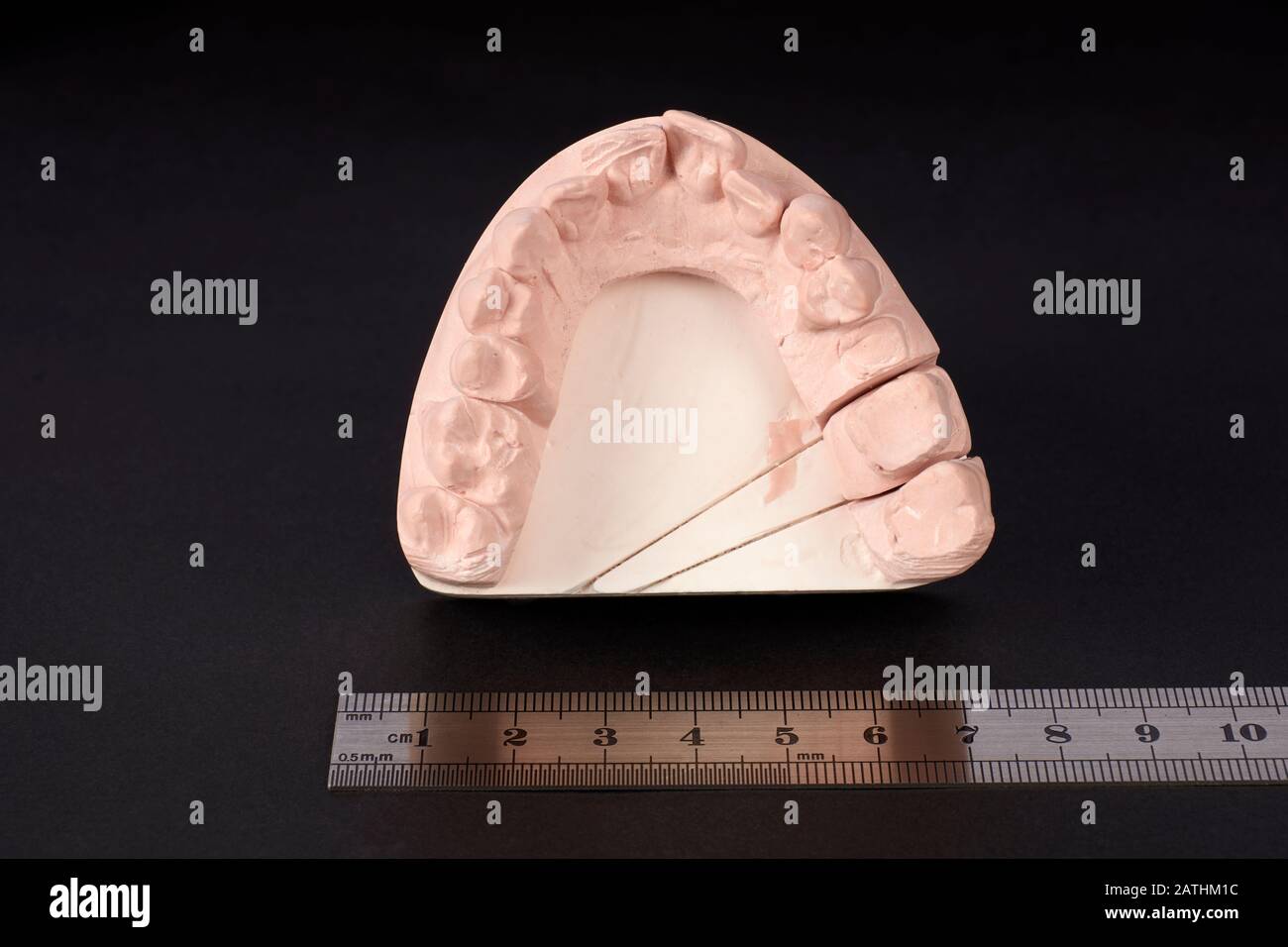 Plaster cast section of upper teeth from middle-aged human male for ...