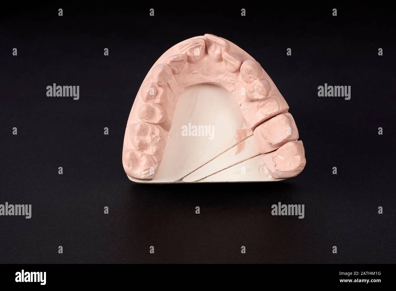 Plaster cast section of upper teeth from middle-aged human male for ...