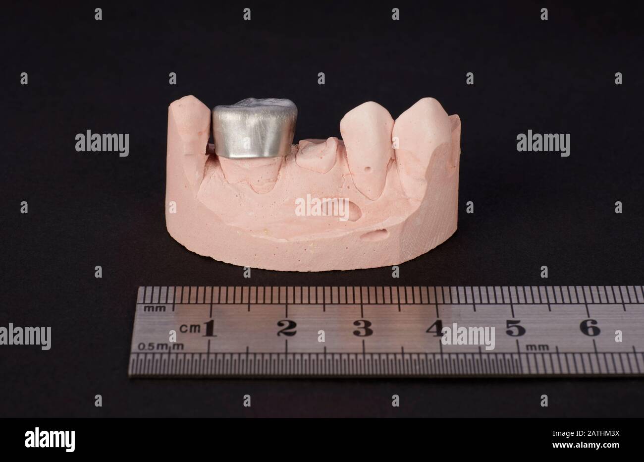 Plaster cast of upper left teeth from middle-aged human male for ...