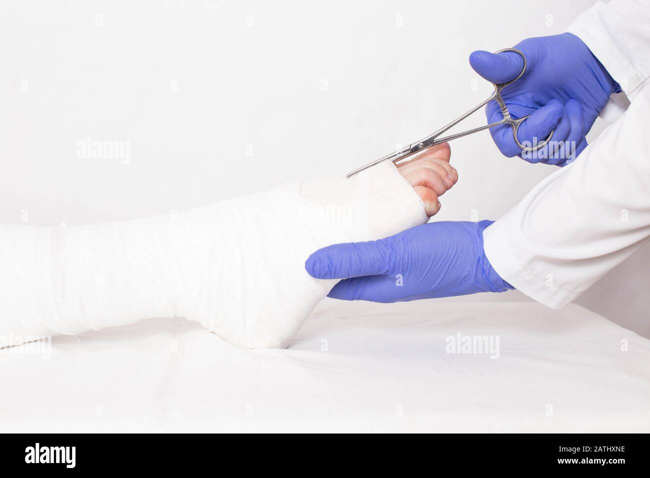 The doctor removes the plaster cast with medical scissors on a white ...