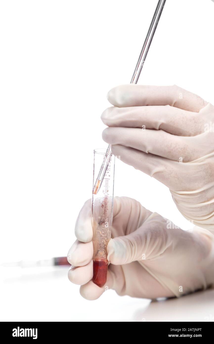 Hand of laboratory assistant holding test tube with blood sample on ...