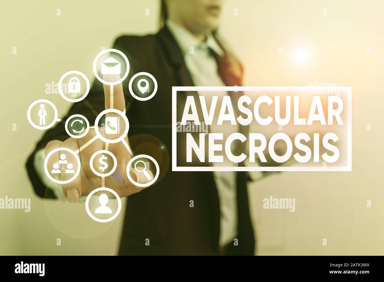 Writing note showing Avascular Necrosis. Business concept for death of ...