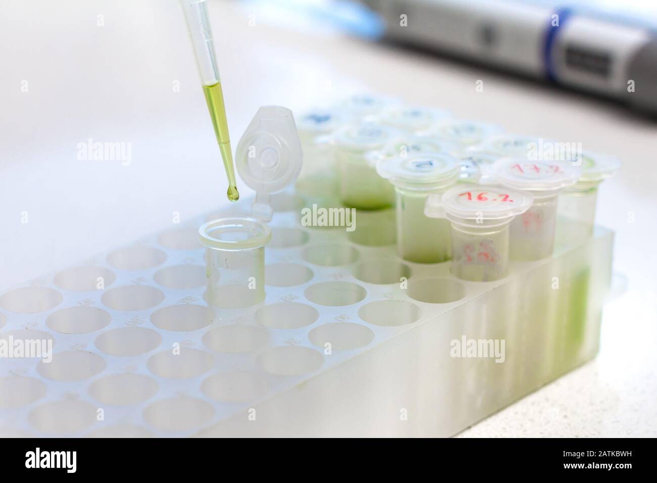 Clinical laboratory in process of chemical analysis. Collection of ...