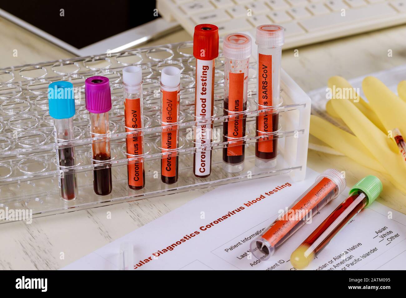 2019-nCoV from China the virus causes atypical pneumonia complete blood ...