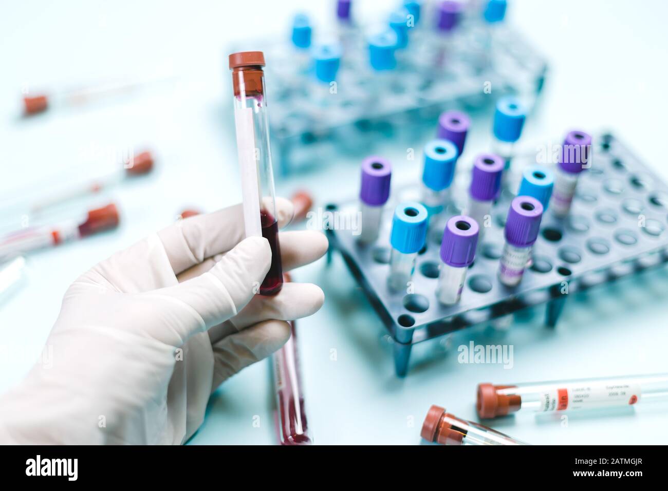 Blood test laboratory hi-res stock photography and images - Alamy