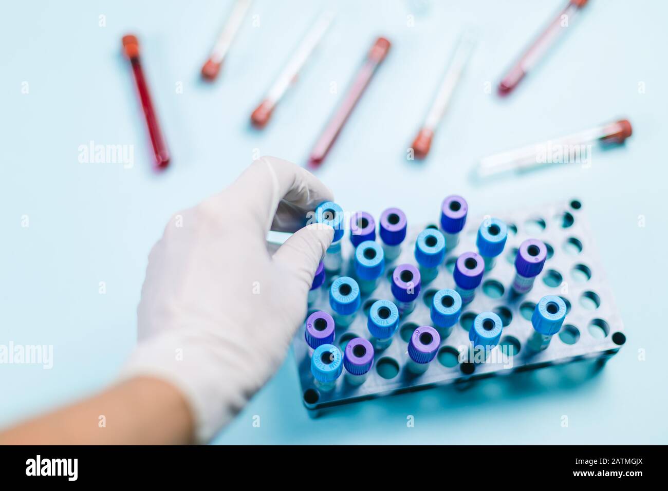 Doctor in the analytical laboratory who picks up a vial from the rack ...