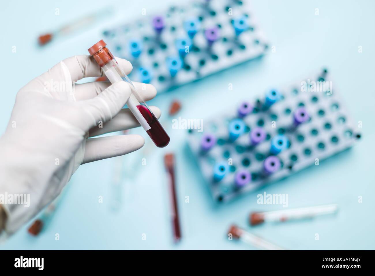 Blood vial hi-res stock photography and images - Alamy