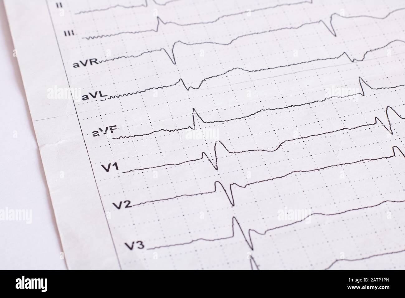 Cardiogram results on white paper close up, heart health Stock Photo ...