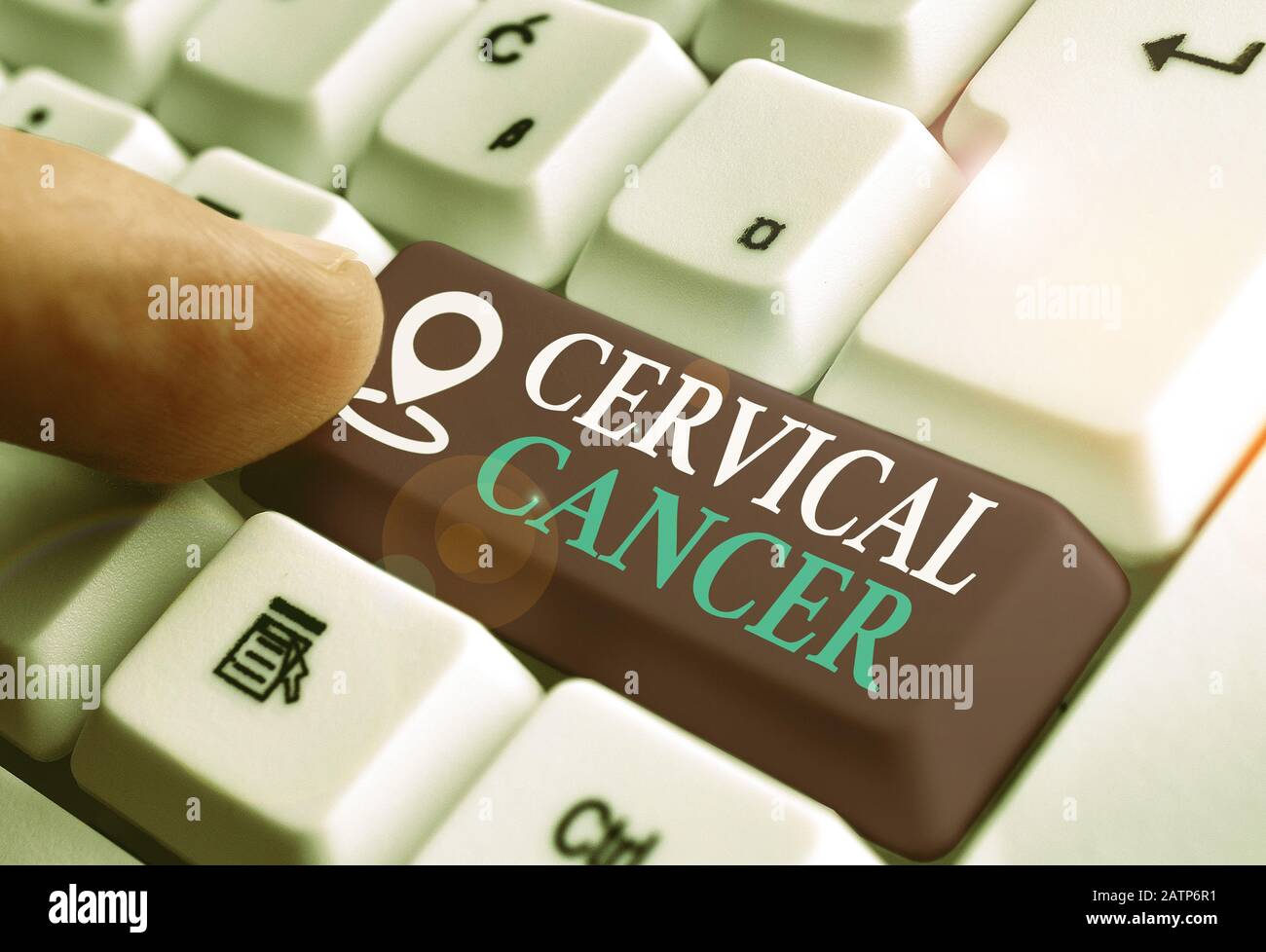 Handwriting text Cervical Cancer. Conceptual photo type of cancer that ...