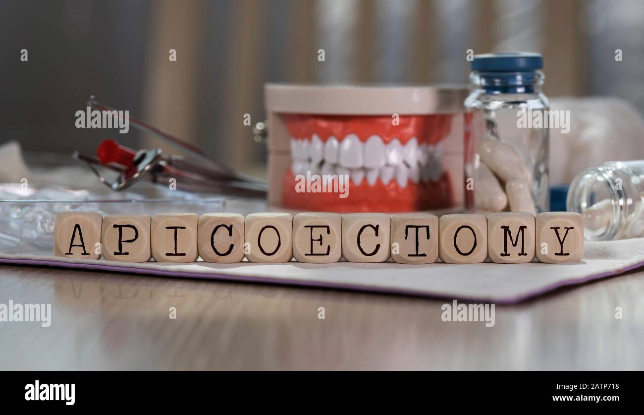 Apicoectomy hi-res stock photography and images - Alamy