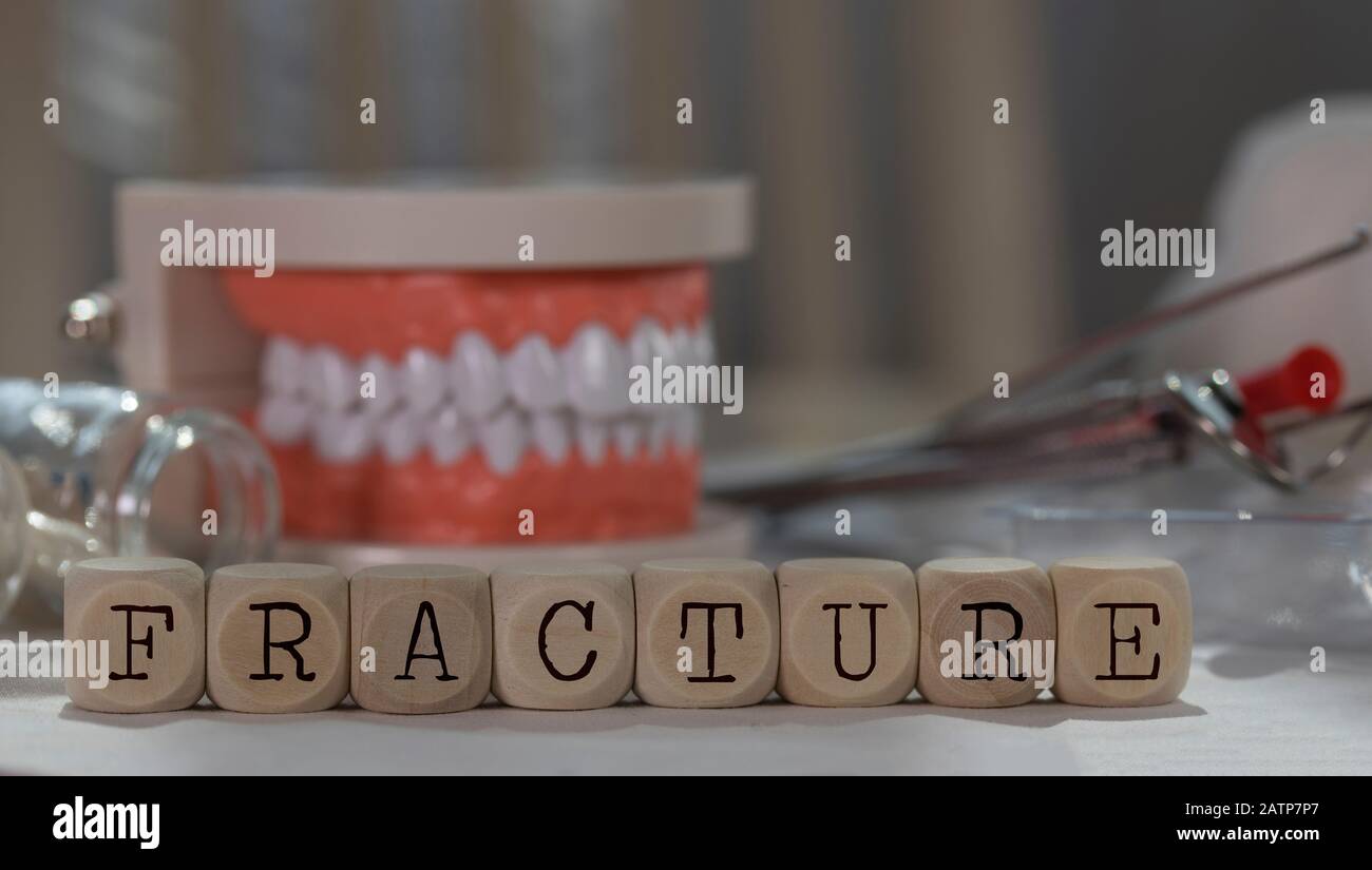 Human jaw fracture hi-res stock photography and images - Alamy