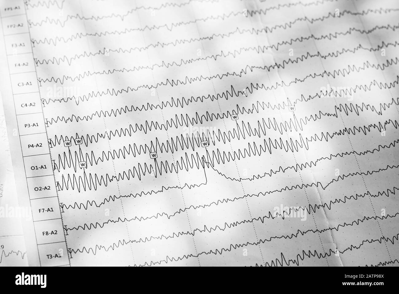 Electroencephalogram result on paper closeup, brain activity test Stock ...