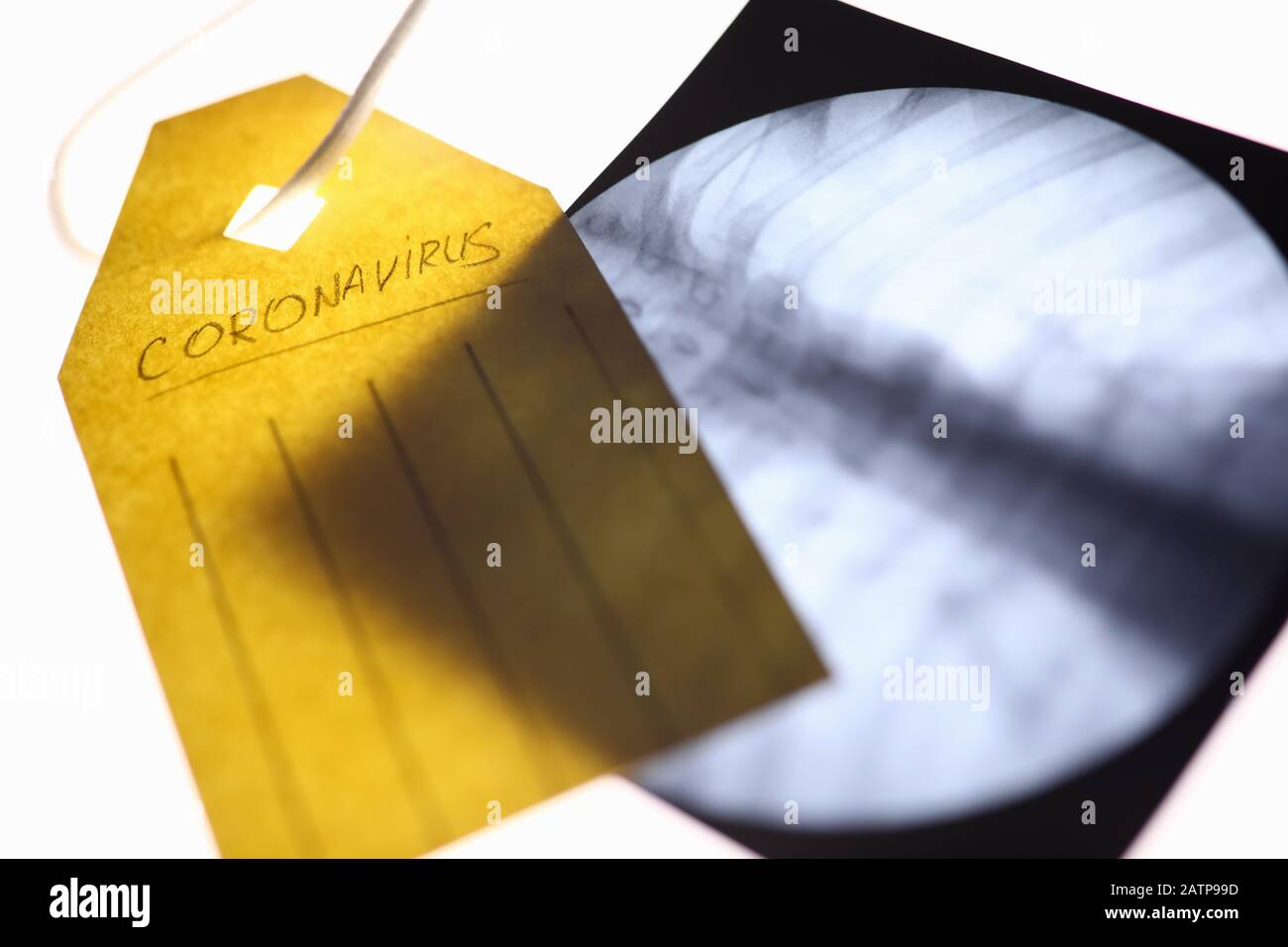 Human lung ray analysis hi-res stock photography and images - Alamy