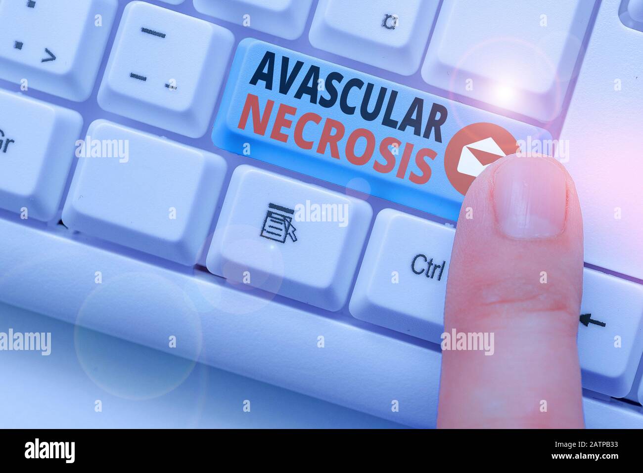 Writing note showing Avascular Necrosis. Business concept for death of ...