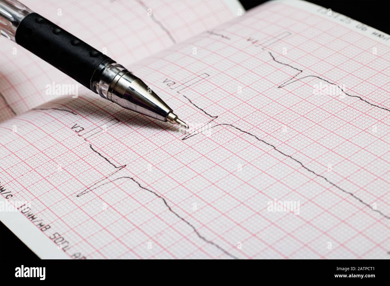 Black pen and cardiogram line close up Stock Photo - Alamy
