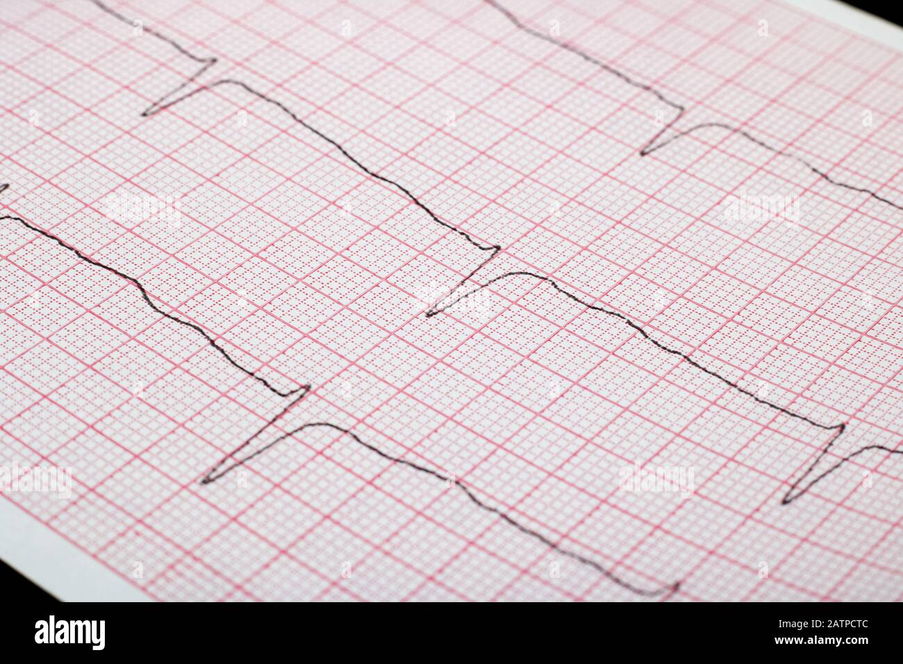 Cardiogram line close up, heart diseases Stock Photo - Alamy