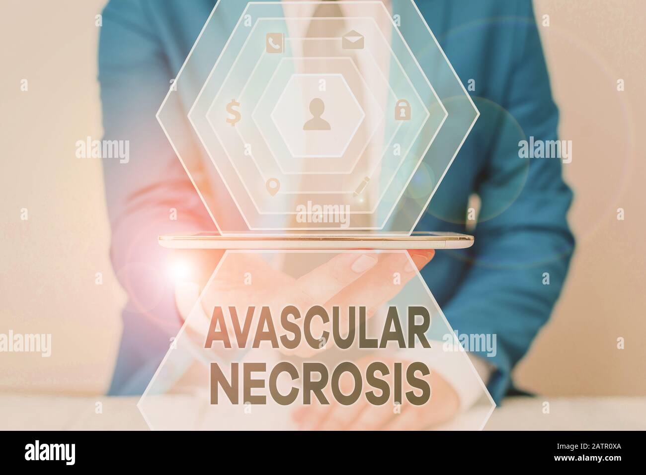 Handwriting text Avascular Necrosis. Conceptual photo death of bone ...