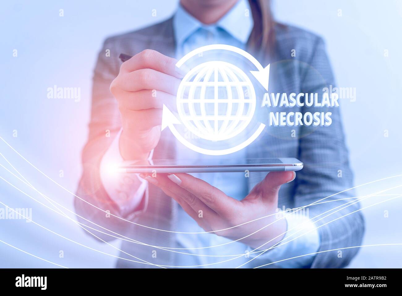 Text sign showing Avascular Necrosis. Business photo showcasing death ...