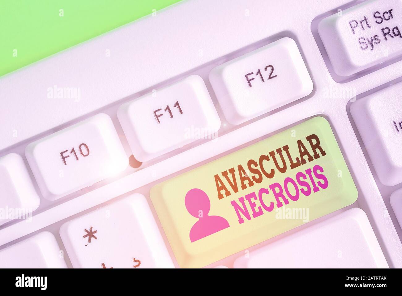 Conceptual hand writing showing Avascular Necrosis. Concept meaning ...
