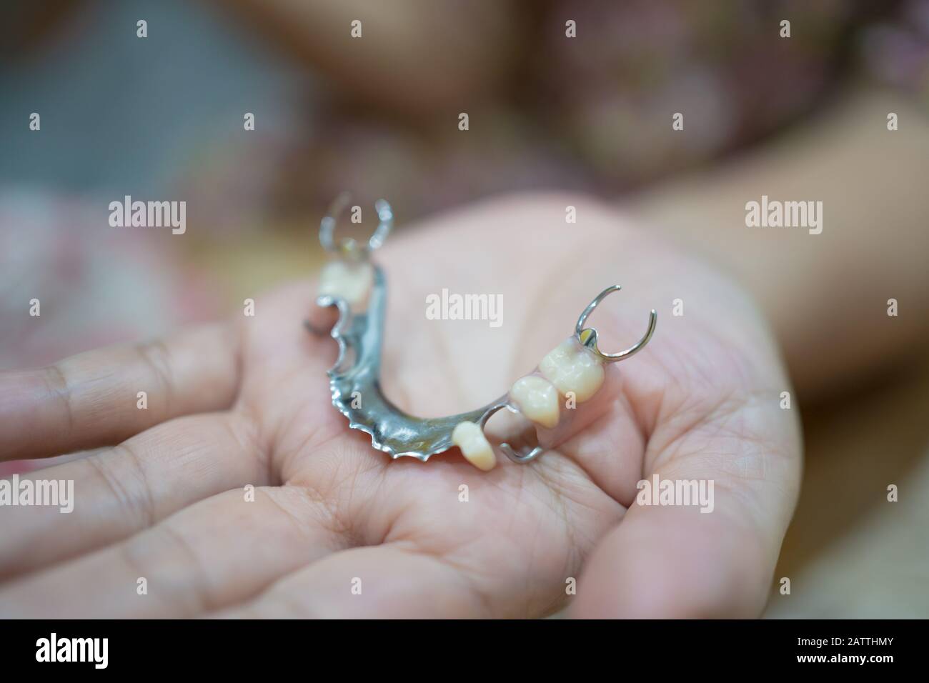 Tooth supported partial denture with metal base in elderly people hand ...