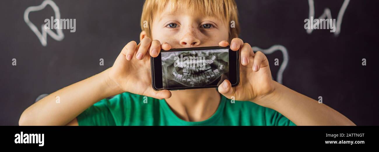The boy shows his X-ray image of his teeth with an abnormally strange ...