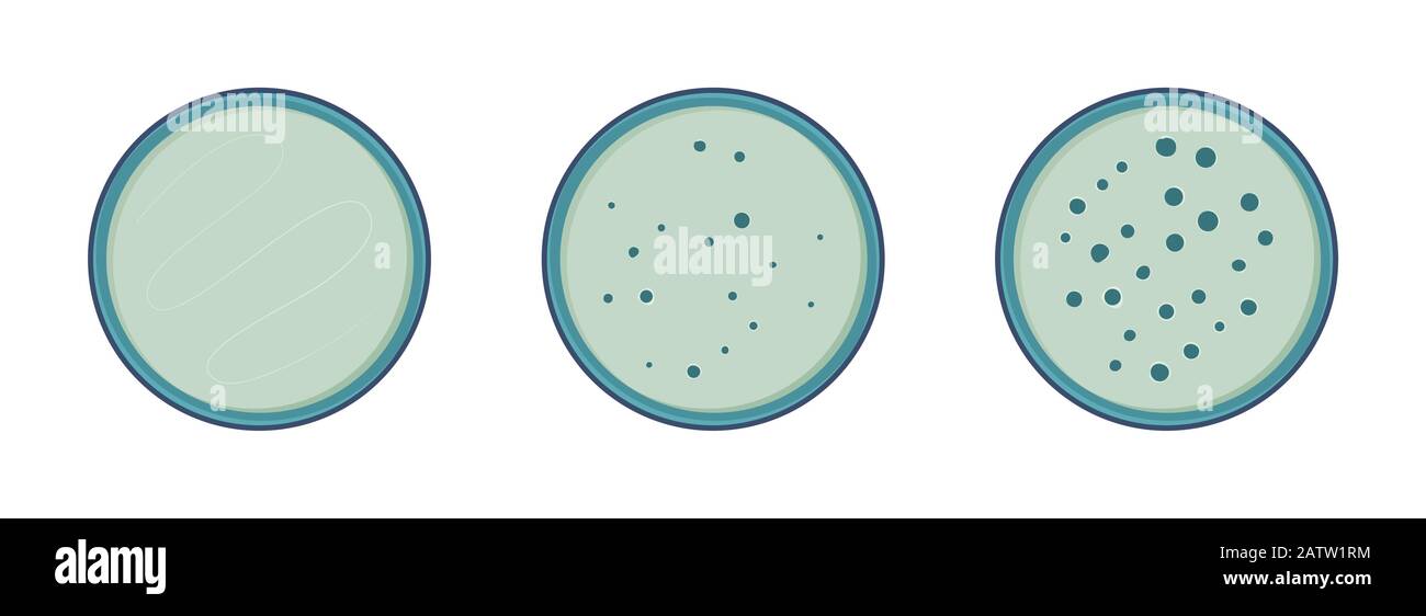 Microbiology. Colony bacteria growth in petry dish, 3 stages, vector ...