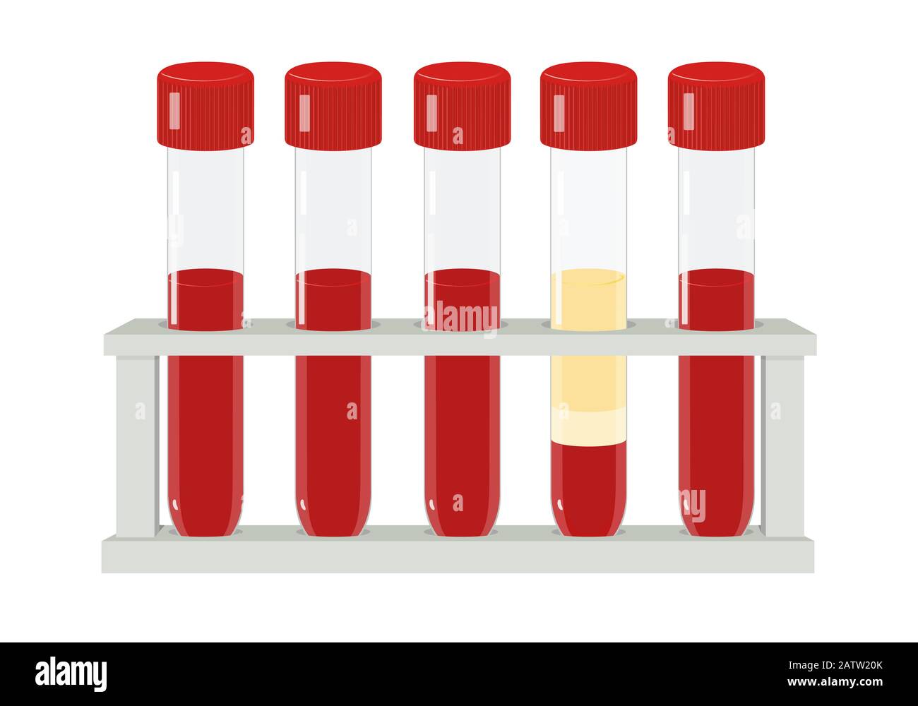 Blood laboratory test Cut Out Stock Images & Pictures - Alamy