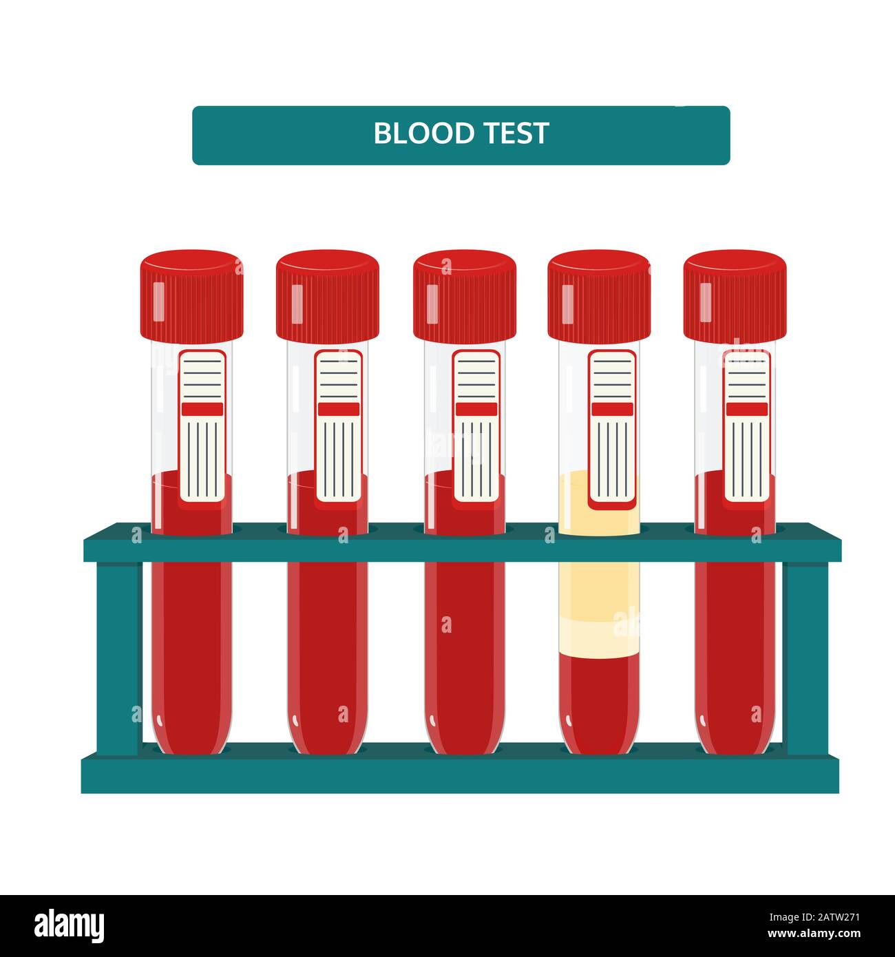 Vacutainer blood tubes Cut Out Stock Images & Pictures - Alamy