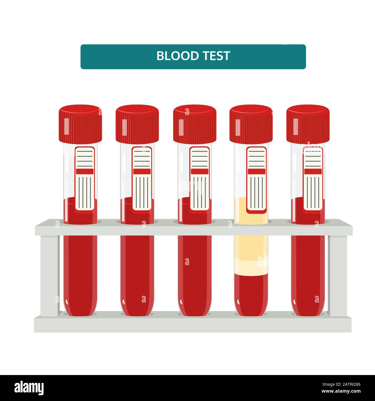 Five blood red test tubes in rack, medical vector illustration Stock ...