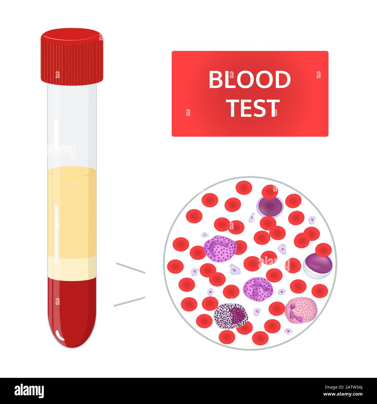 Medical vector concept: blood analysis in test tubes and composition of ...